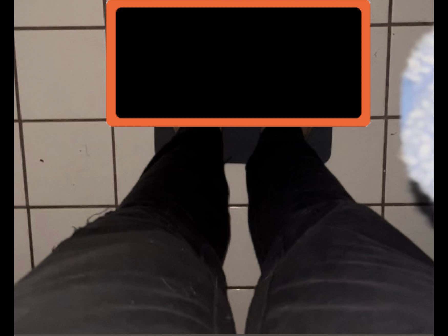 Chief Has The GNARLIEST Feet Of All Time | Barstool Sports