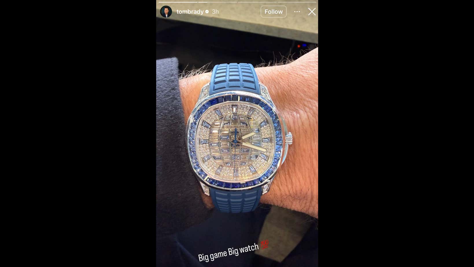 Tom Brady And His Watch Were The Biggest Losers Of Championship Sunday ...