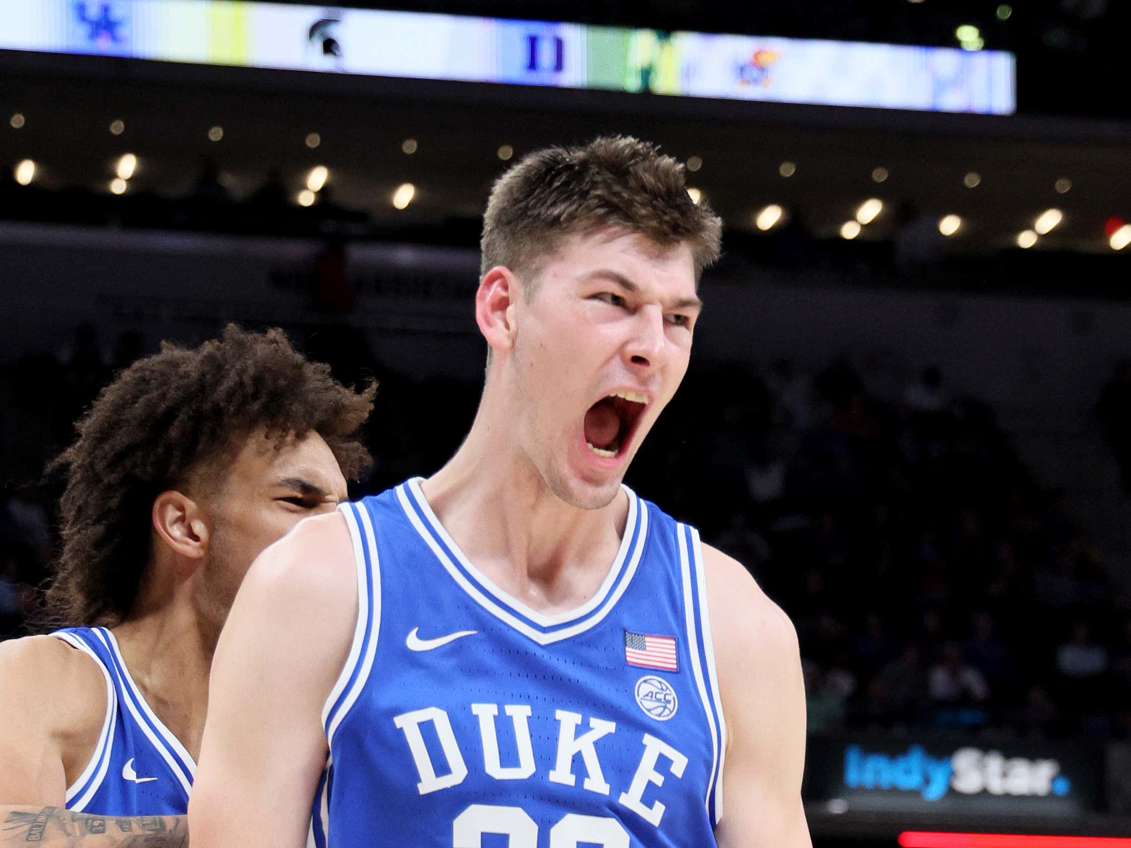 Kyle Filipowski Is An Absolute Warrior For Playing In Tonight's Game ...