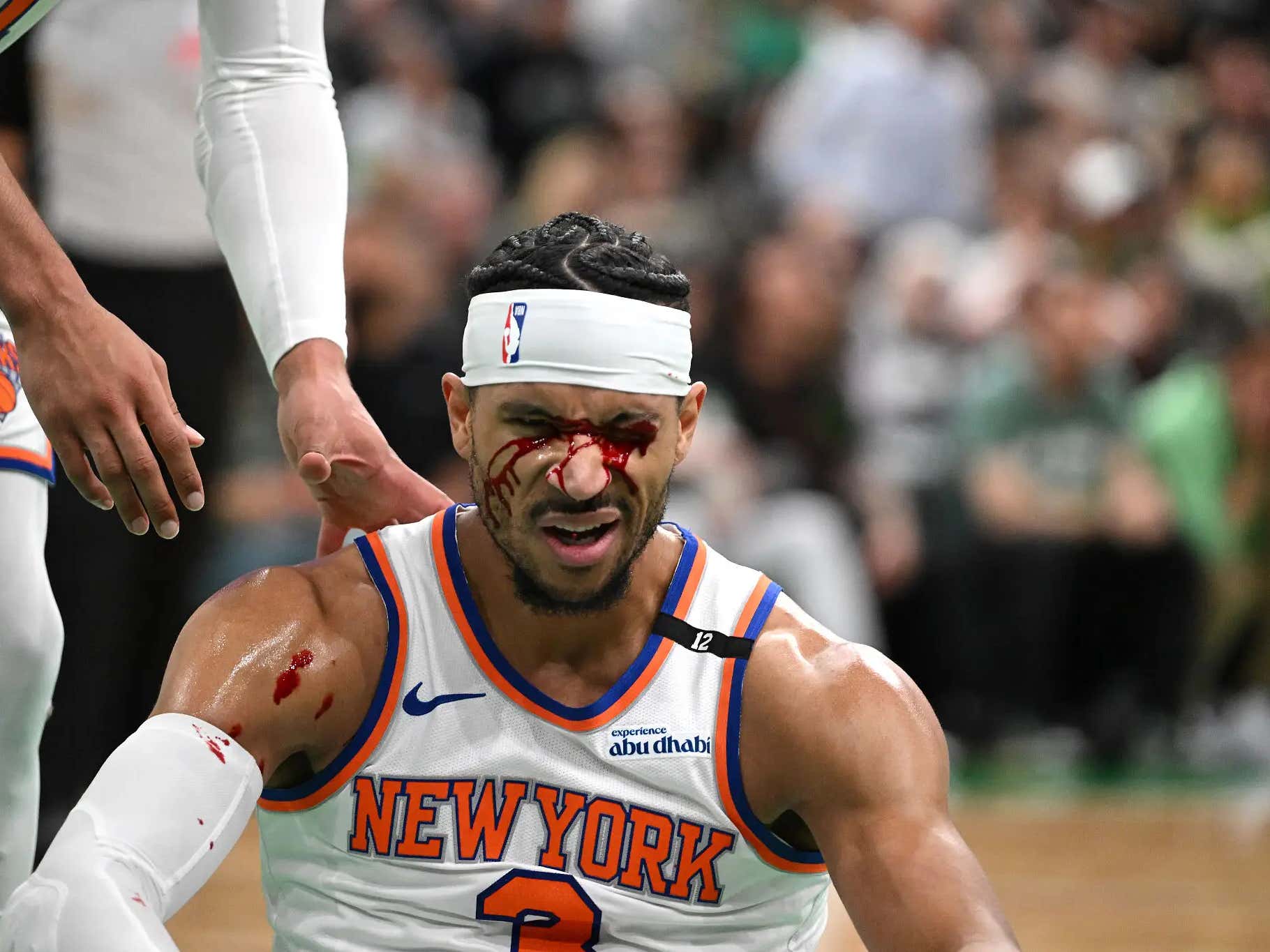 Our Lunatic: Josh Hart Had Blood Gushing All Over His Face, Refused To ...